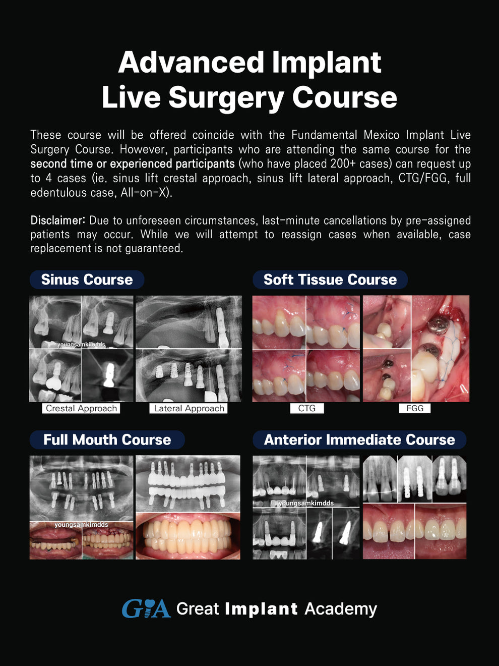 Implant Live Surgery Course: Work on patients – GIA USA