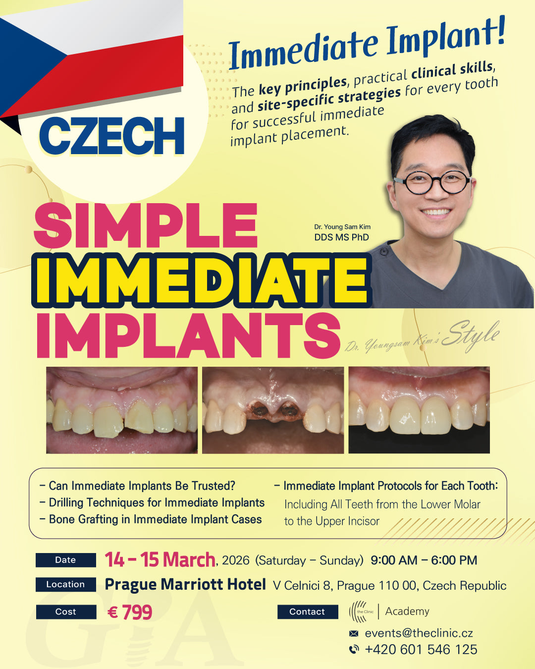 Czech) Simple Immediate Implants [2026/3/14 ~ 3/15] – GIA USA